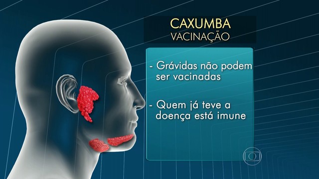 Complicações da caxumba | Fernando Bragança - Pediatria e Homeopatia